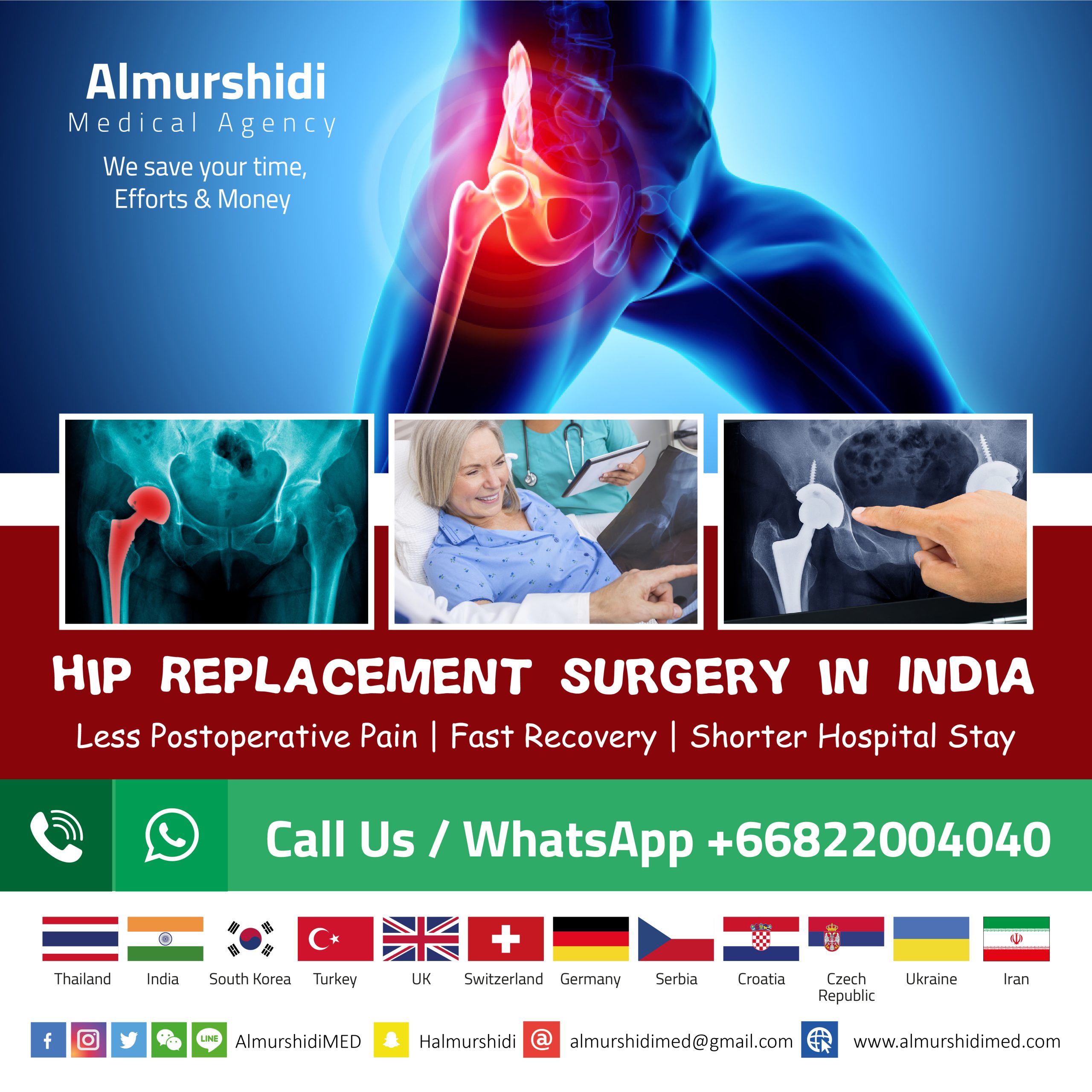 Rediscover Mobility And Comfort With Hip Replacement Surgery ...