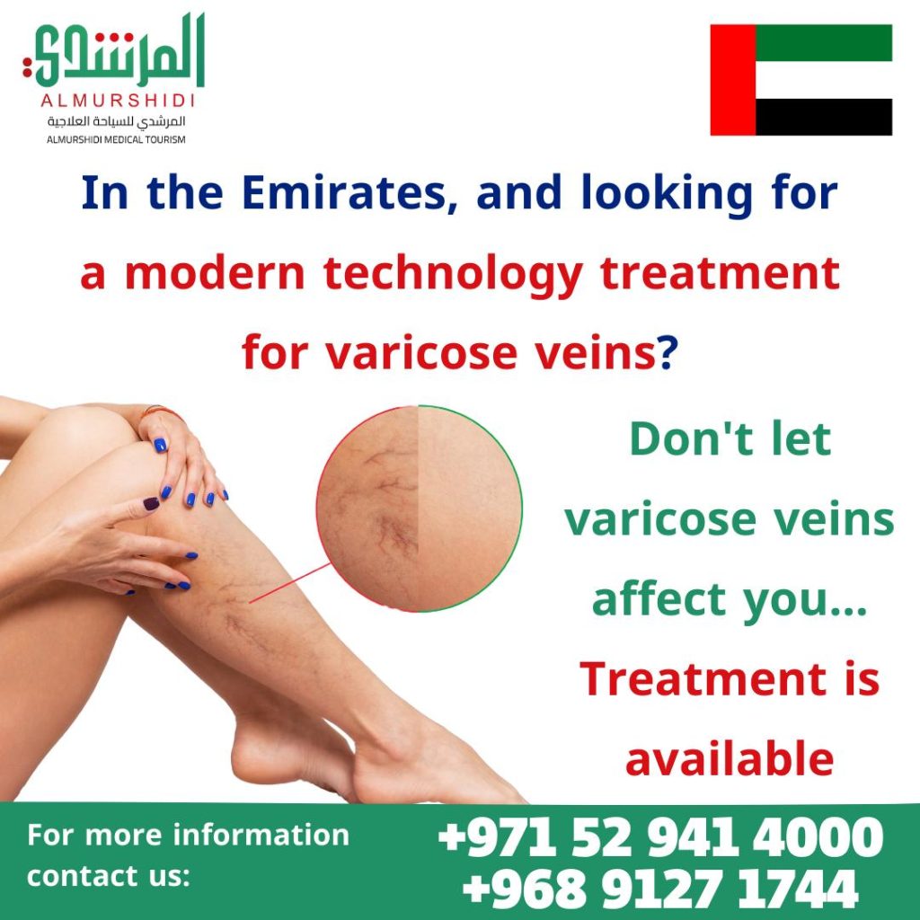 How can varicose veins be treated in the UAE? - Almurshidi Medical ...